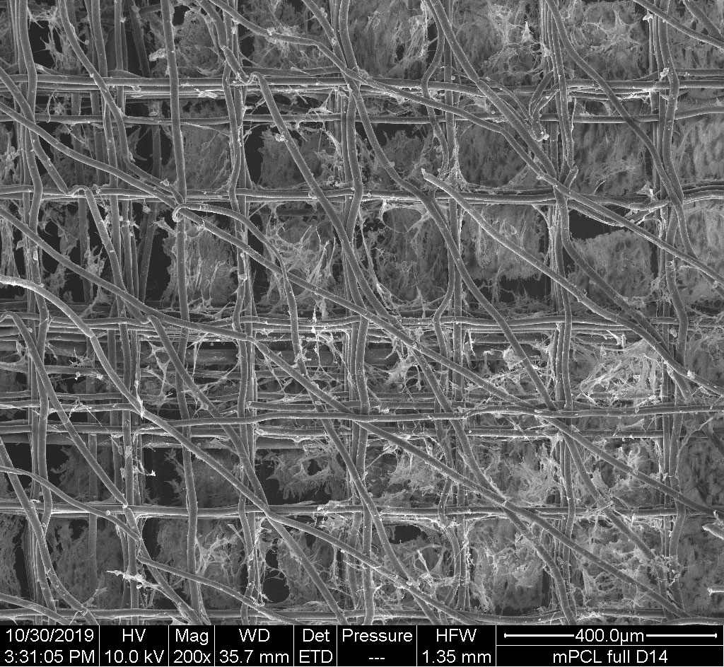 Melt Electrowriting of hierarchical structures for regeneration of hard ...